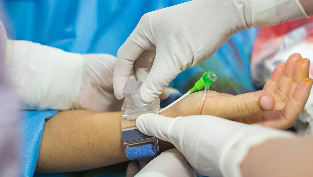 Radial PCI Benefits Seen in Real-world Analysis, Mirroring RCTs | tctmd.com